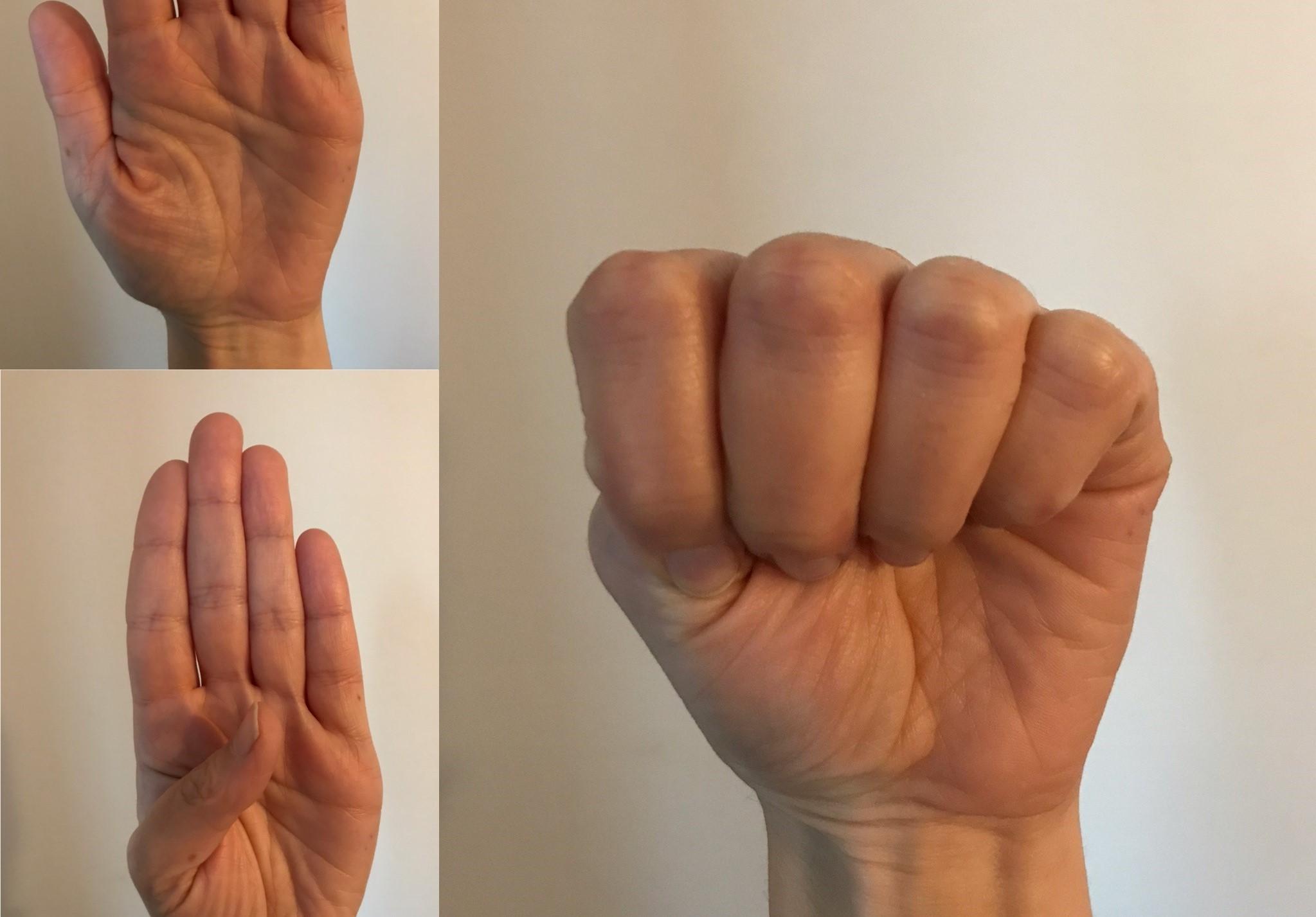 Gewalt gegen Frauen: Dieses Handzeichen kann Leben retten