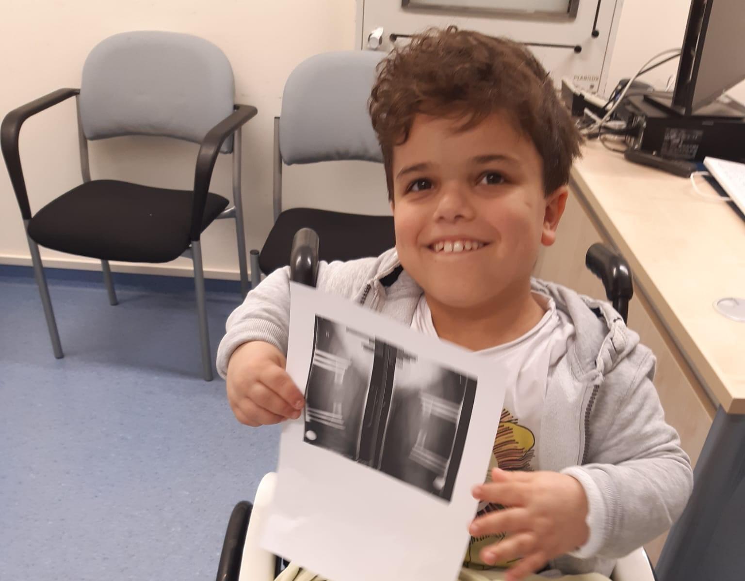 OPs und Behörden-Streit: Wie der neunjährige Milo aus Franken für ein ...