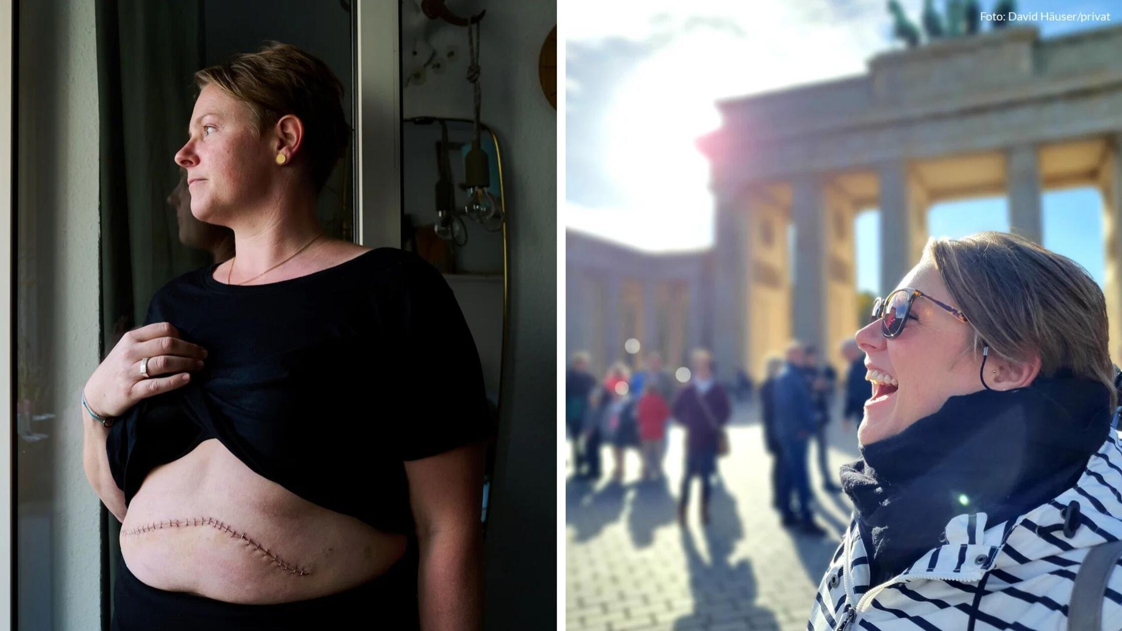 "Uncoologie": Die Nürnbergerin Katharina Wasmeier thematisiert ihre ...